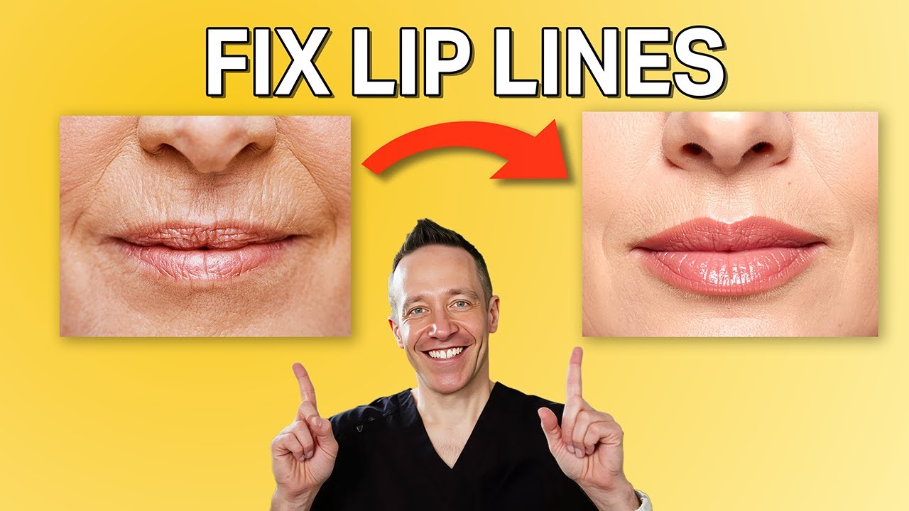 Amazing NEW Treatments for Lip Lines — Doctor Explains - YouTube