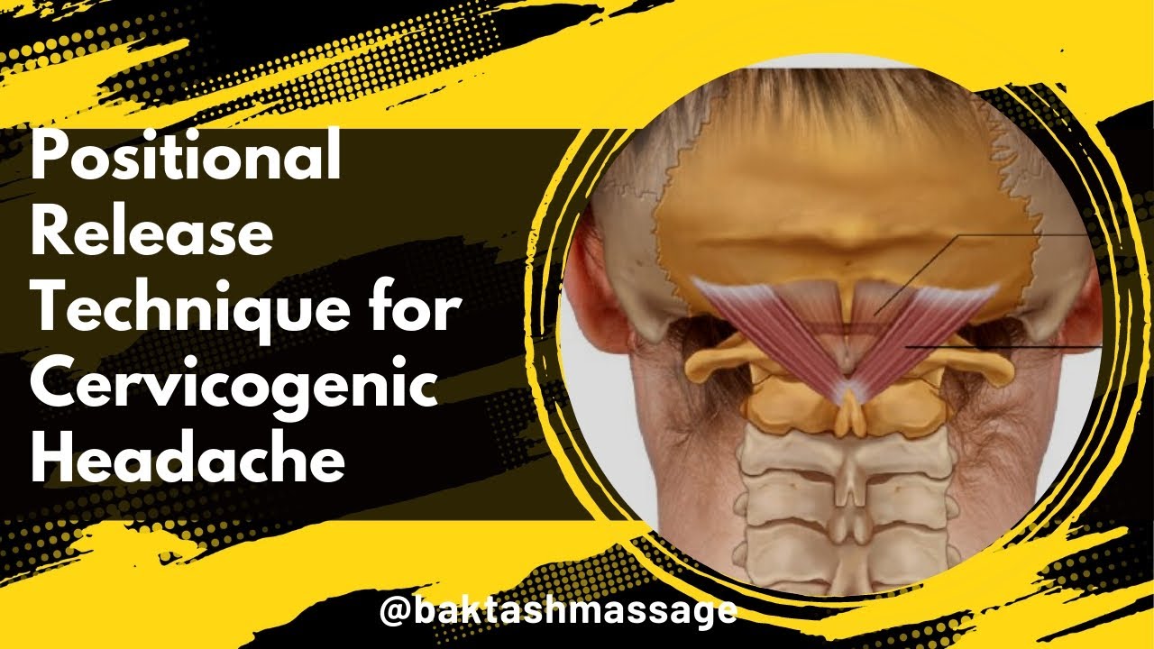 Positional Release Technique. Cervicogenic Headache. @fiziomasaj # ...