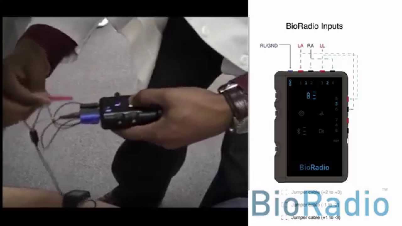 Using the BioRadio to Capture ECG Data - YouTube