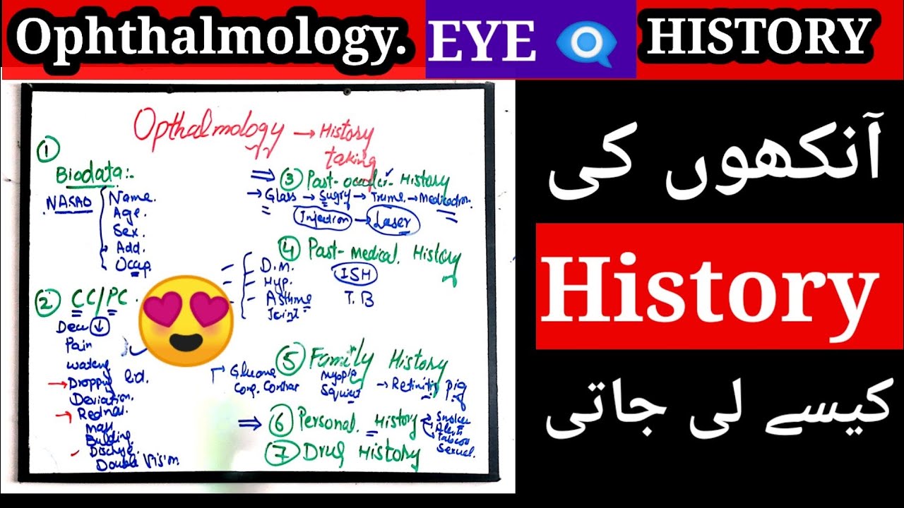 opthalmology history taking Techniques. 😍. #Eye. 🔴🔴#opthalmology ward ...