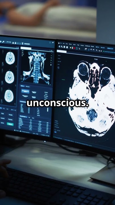 [BrainSpark]: How Does Anesthesia Knock You Out? #science - YouTube