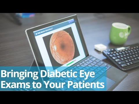 IRIS 5 - Step Solution