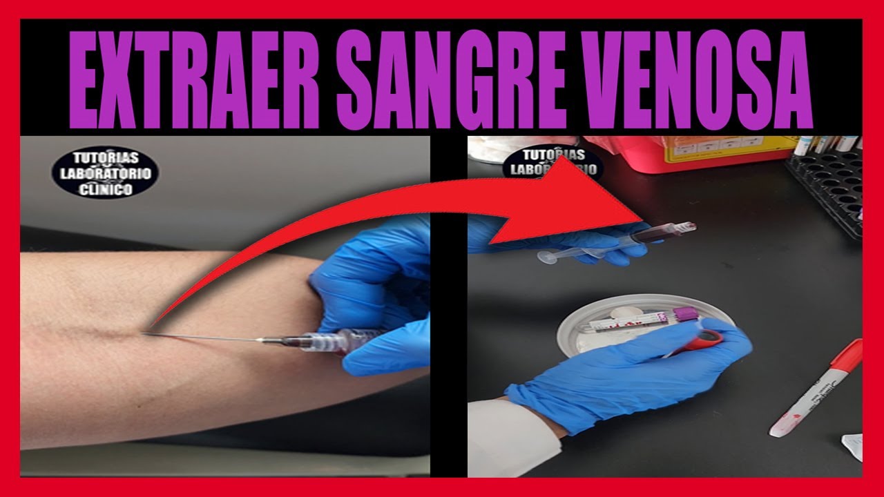 🩸(Tutorial)💉Te Enseño Facil y Rapido a Como Tomar una Muestra de Sangre ...