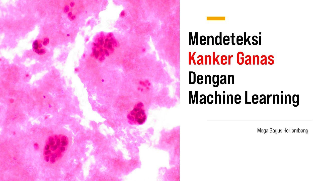 Mendeteksi Kanker Ganas Dengan Machine Learning | Aplikasi Kecerdasan ...