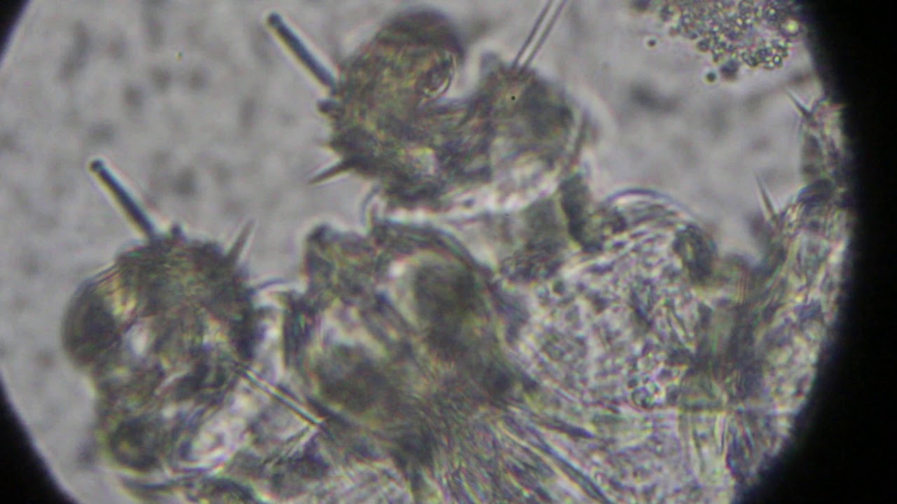 вивисекция клеща Myobia musculi муви 1...001 - YouTube