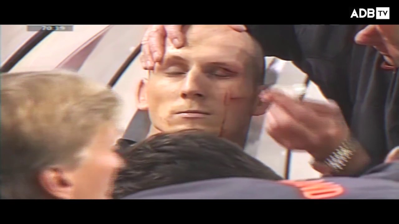 Jaap Stam eyebrow injury - YouTube
