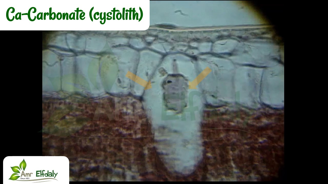 Ca-Carbonate (cystolith) - YouTube
