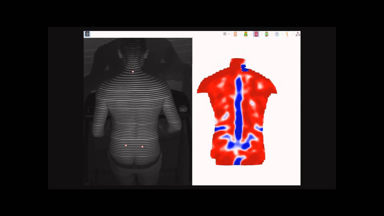 DIERS 4D motion verschiedene Ansichten - YouTube