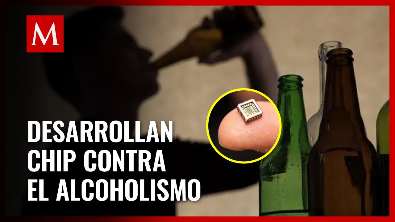 Implante de chip contra alcoholismo es aplicado por primera vez en ...