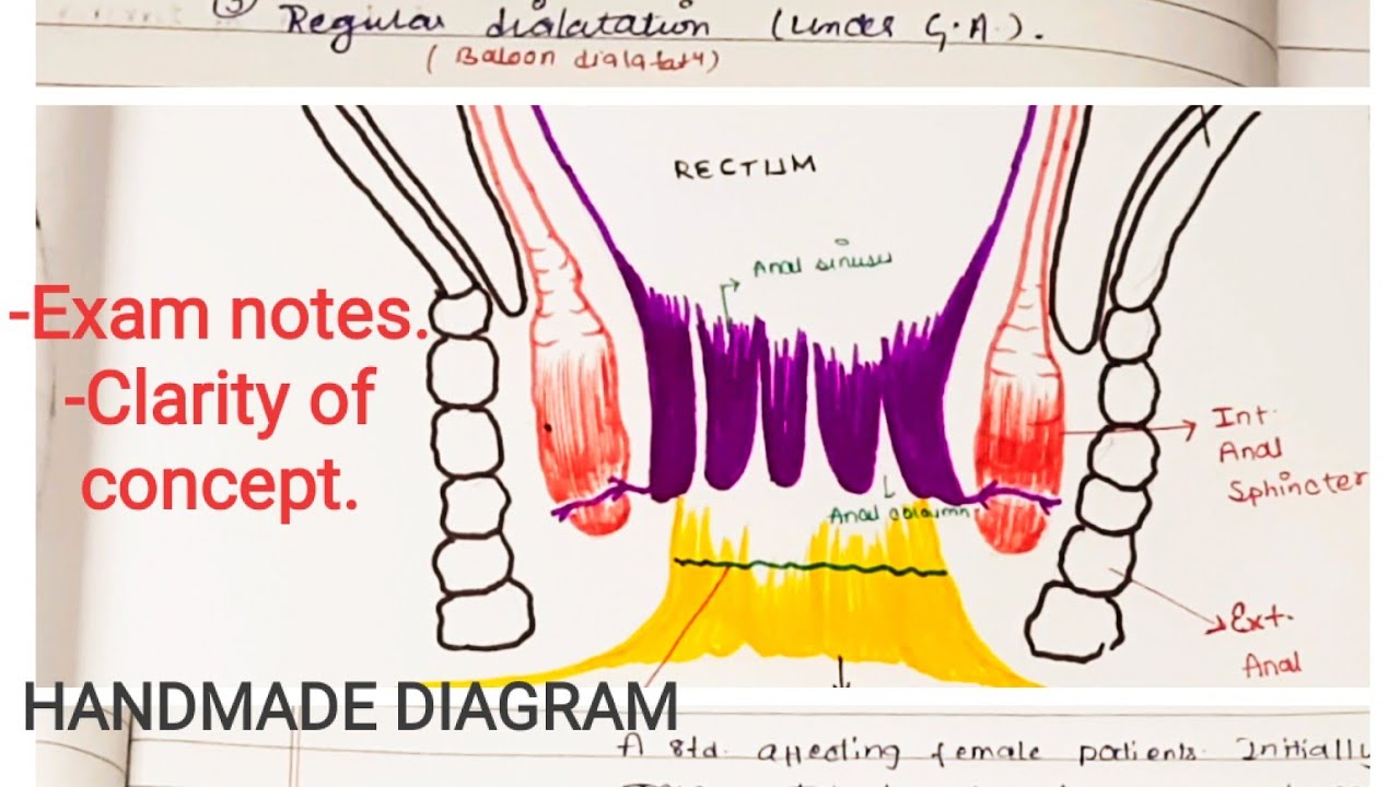 STRICTURE OF ANAL CANAL AND RECTUM..NOTES FOR THEORY EXAM. - YouTube