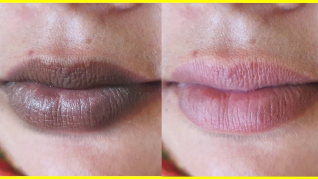Pink Soft Plump Lips For This Wedding Season In Just 5 Mins YouTube pink-soft-plump-lips-for-this-wedding-season-in-just-5-mins-youtube