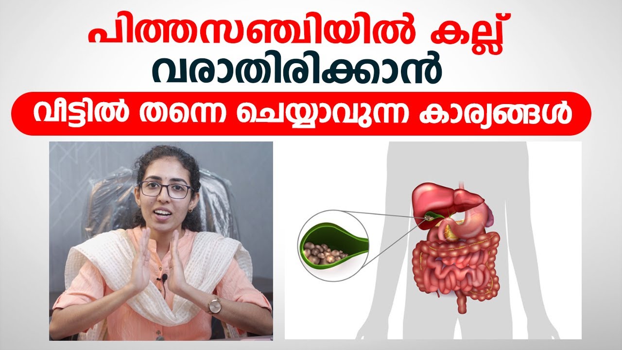 പിത്തസഞ്ചിയിൽ കല്ല് വരാതിരിക്കാൻ വീട്ടിൽ തന്നെ ചെയ്യാവുന്ന കാര്യങ്ങ ...
