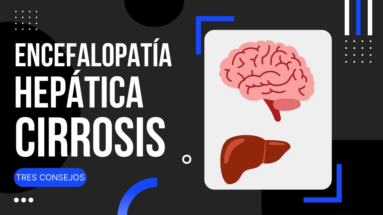 Encefalopatía hepática en cirrosis hepática - YouTube