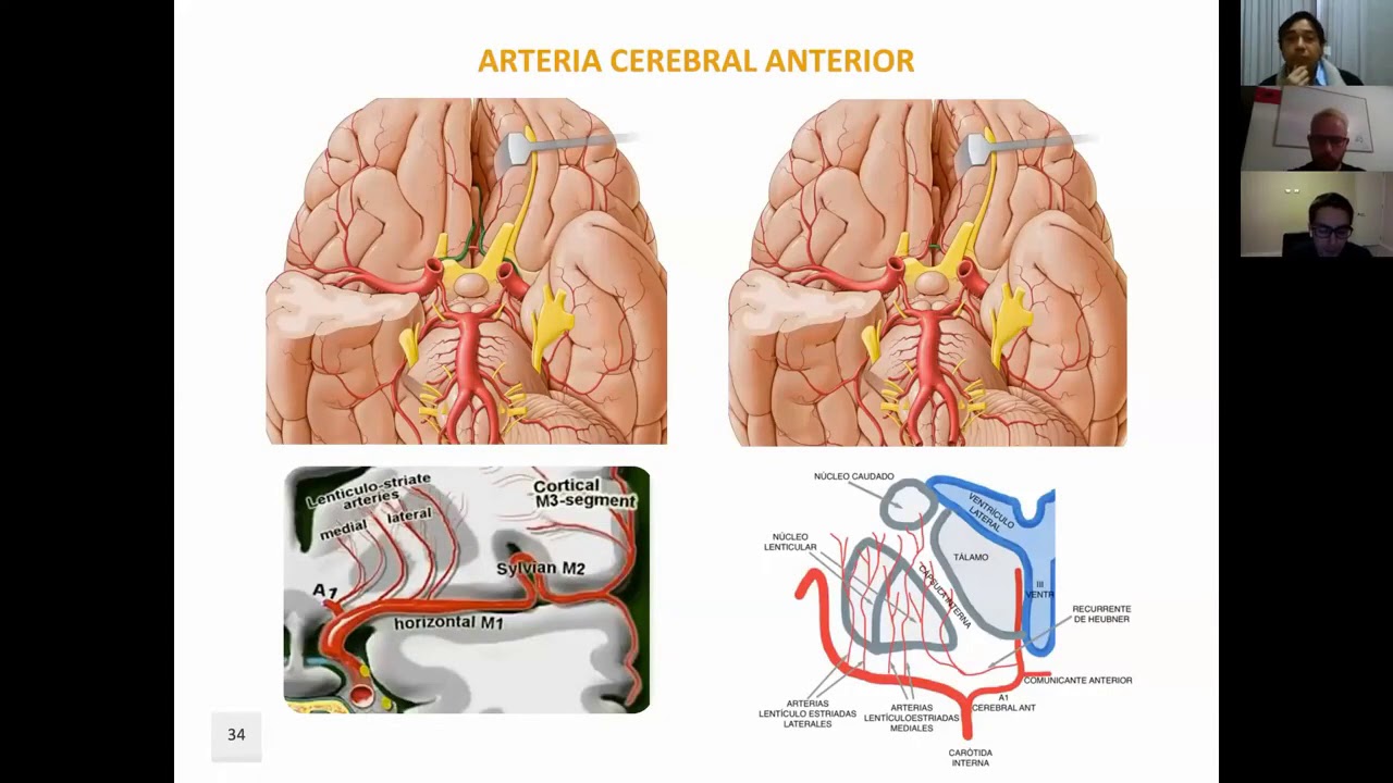 Accidente cerebrovascular (ACV) Parte3: Neuroanatomia Basica para la ...