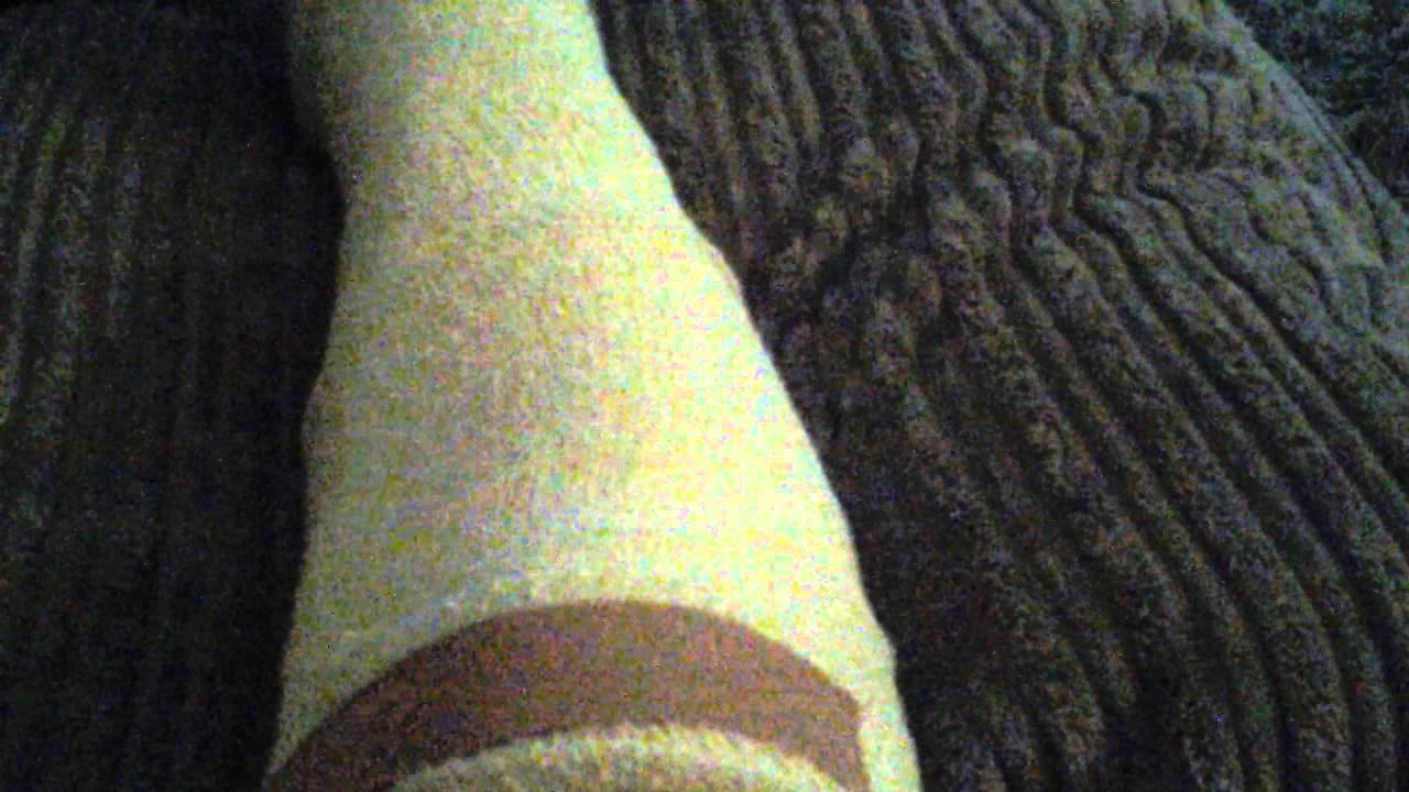 Broke my leg - YouTube