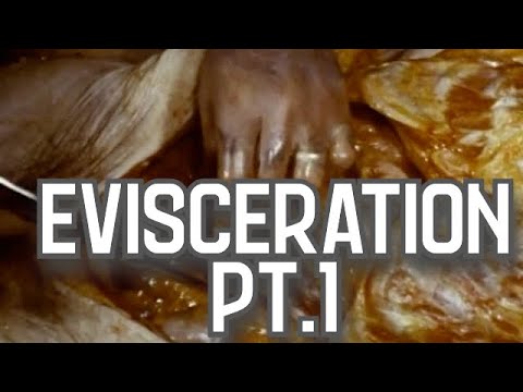 Autopsy dissection technique 1970s film. Evisceration (disembowelment) pt. 1