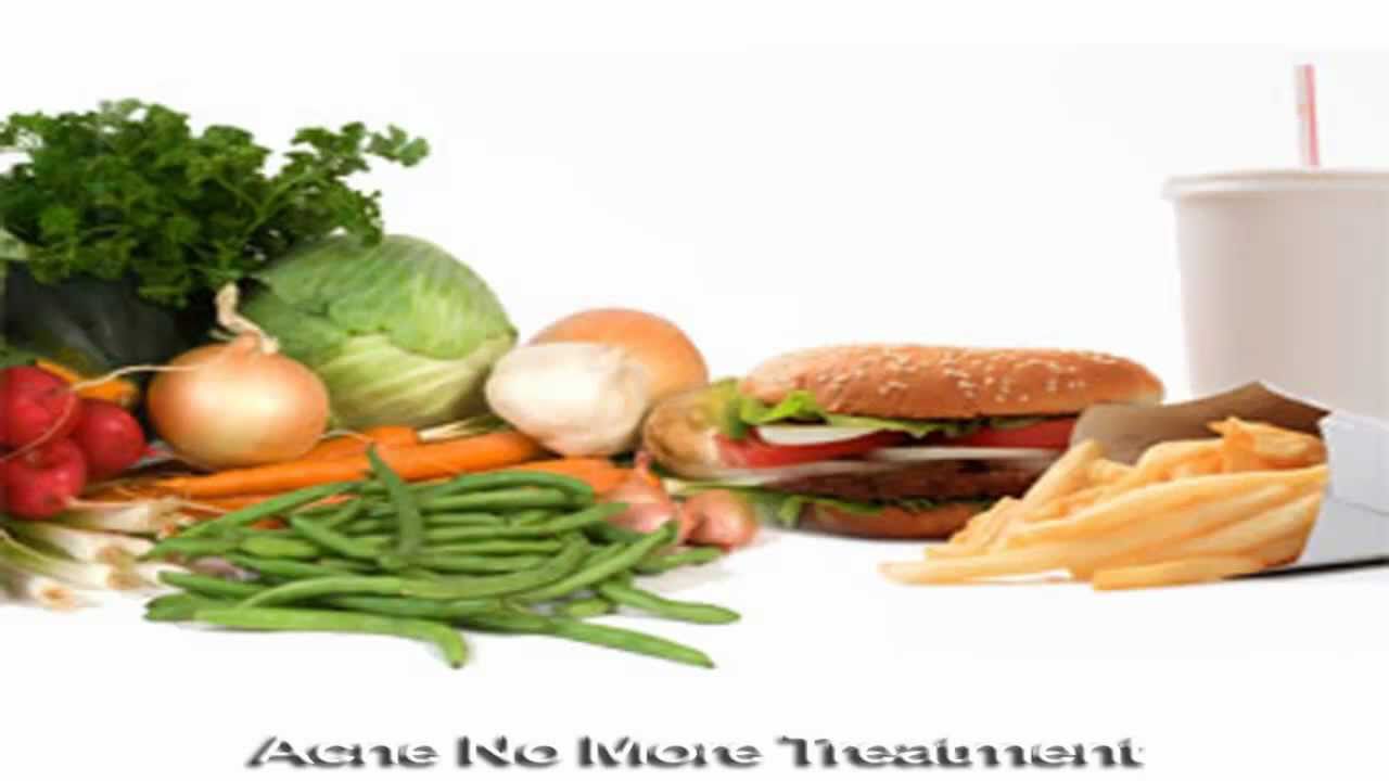 How To Prevent Acne : With Eating The Correct Foods Are Highly ...