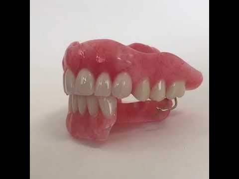 Gold tooth full upper denture - YouTube