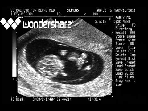 Baby Tuft at 10 Weeks - YouTube