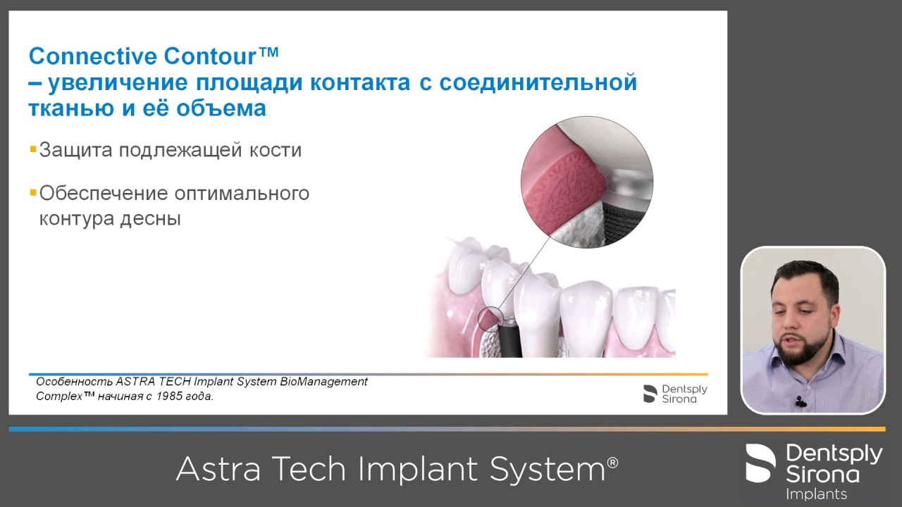 Astra Tech Implant System. Видео-лекция по хирургии. - YouTube