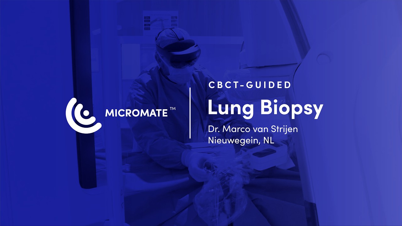 Micromate™ | CBCT-guided, Robotic-assisted Lung Biopsy - YouTube