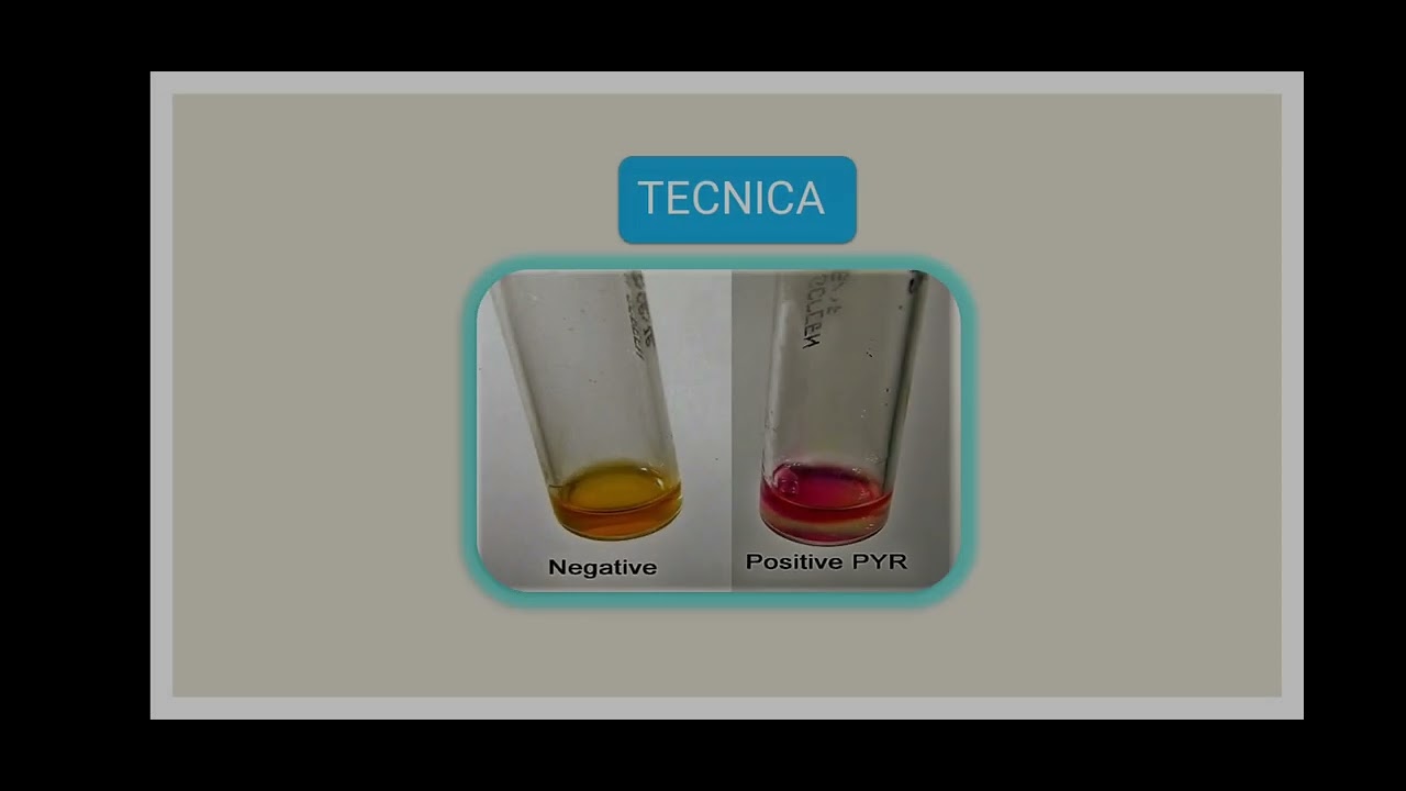 pruebas PYR - YouTube