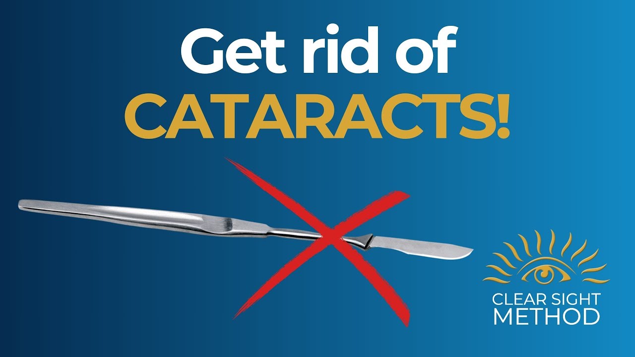 Prevent & Reverse Cataracts Naturally: Eye Exercises & Tips - YouTube