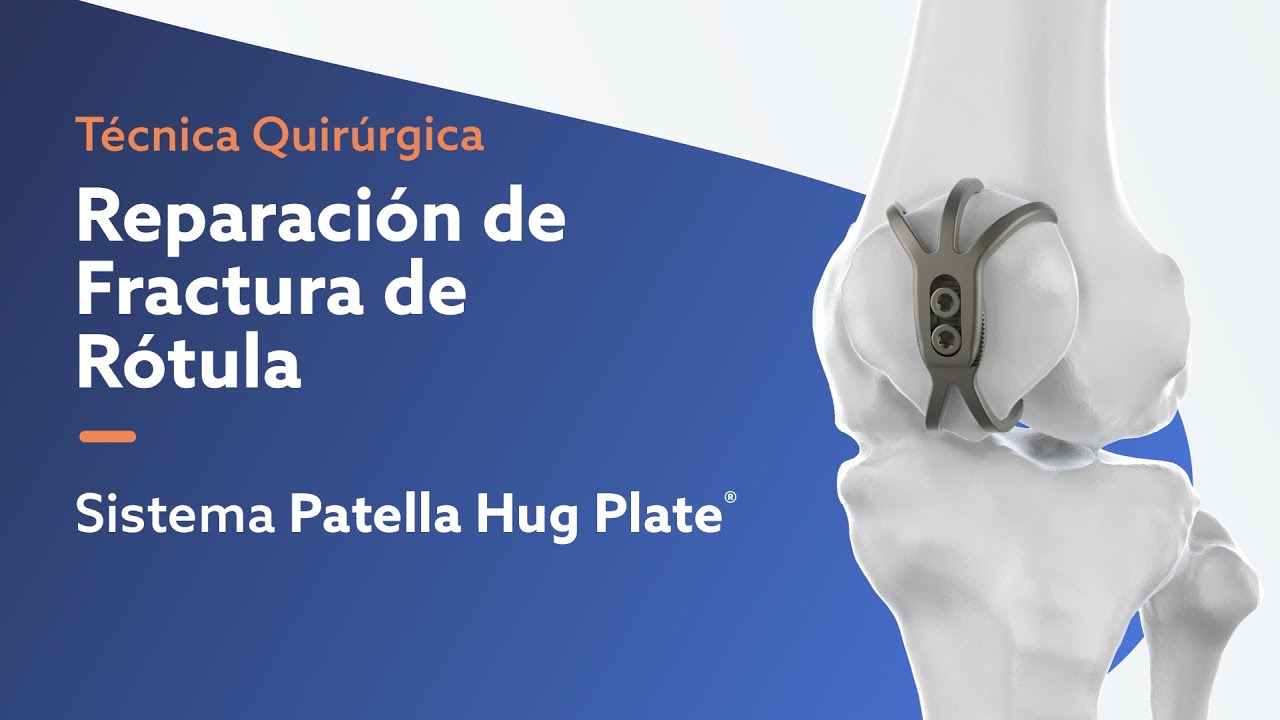 Reparación de rótula con PHP - Patella Hug Plate® - Técnica Quirúrgica ...