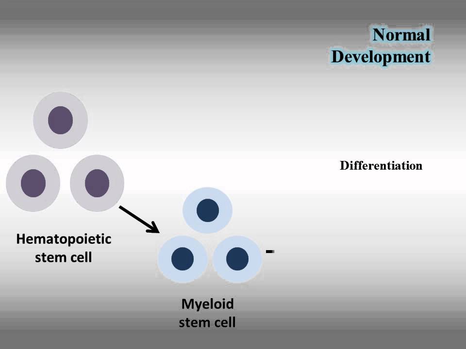 SCID gene therapy class - YouTube