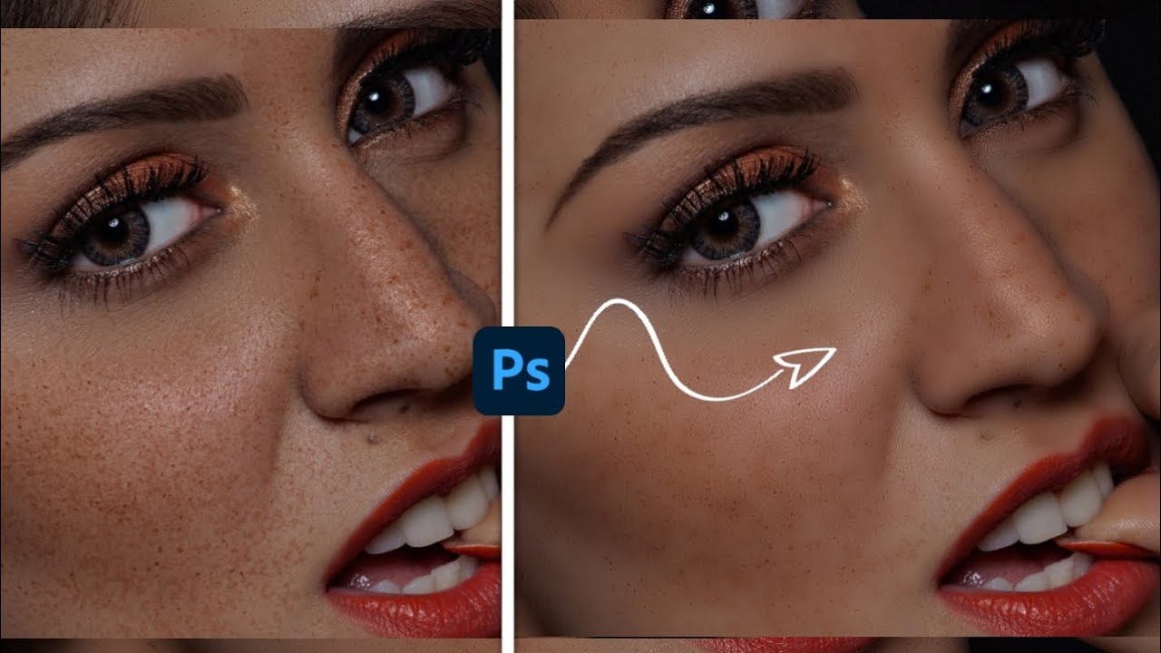 Skin Retouching in Photoshop | Photo editing tutorial in Photoshop | How to Remove skin spot ...