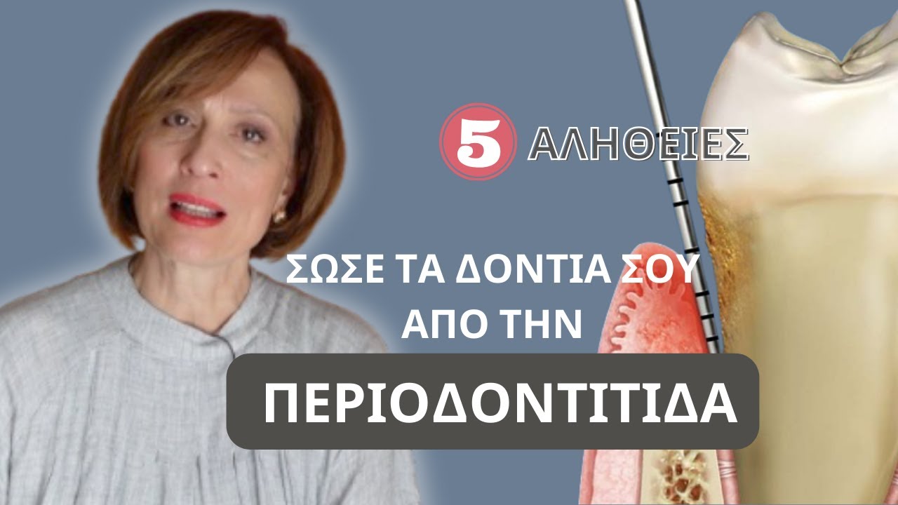 5 ΑΛΗΘΕΙΕΣ για την ΠΕΡΙΟΔΟΝΤΙΤΙΔΑ, που πρέπει να γνωρίζεις - YouTube
