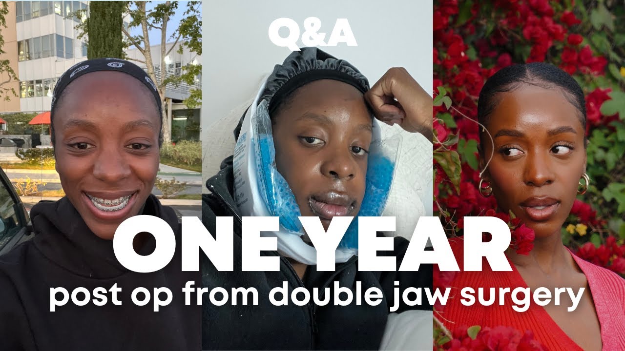 JAW SURGERY Q A ONE YEAR POST OP FROM DOUBLE JAW SURGERY emotional jaw-surgery-q-a-one-year-post-op-from-double-jaw-surgery-emotional