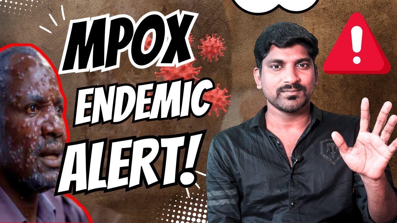 Mpox Outbreak Symptoms, History and Latest Emergency Explained | Tamil ...