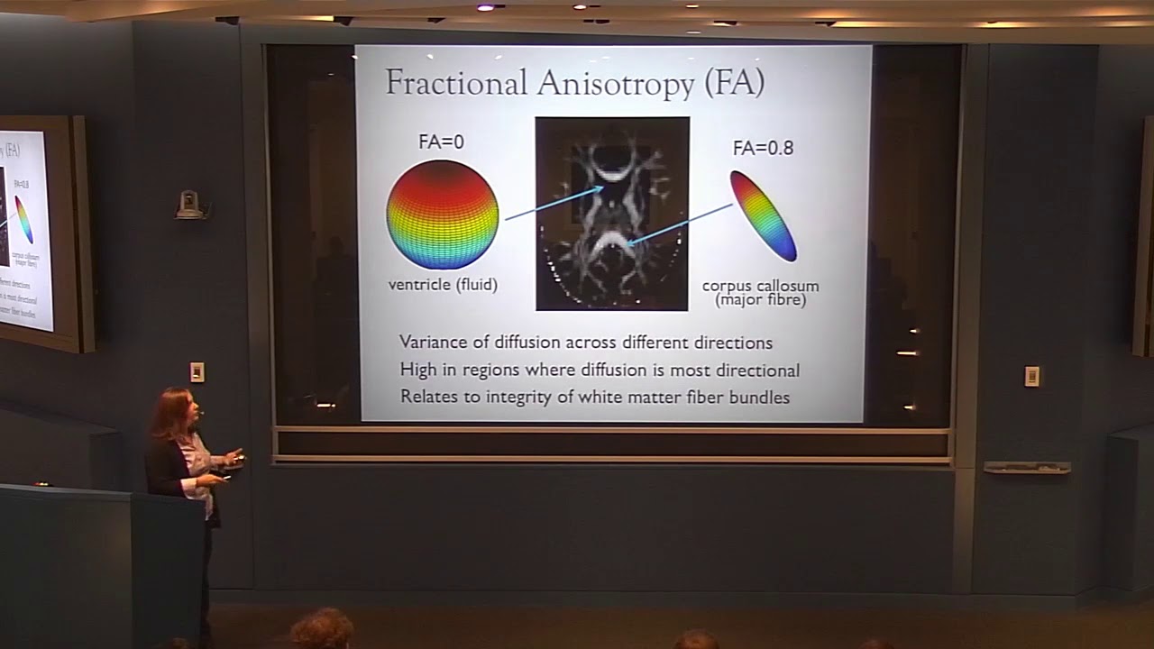 Karla Miller, Brian Wandell, Stephen Smith - Diffusion Tensor Imaging ...