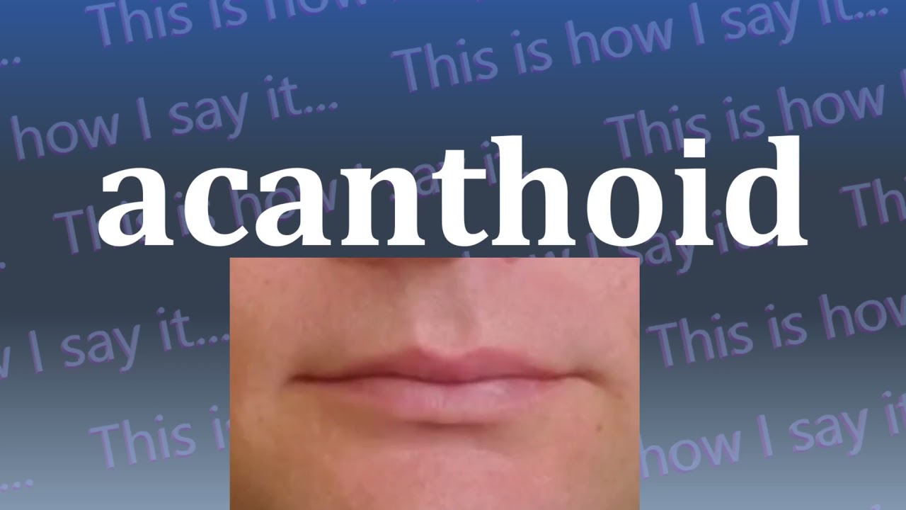 This is How I Say...acanthoid - YouTube
