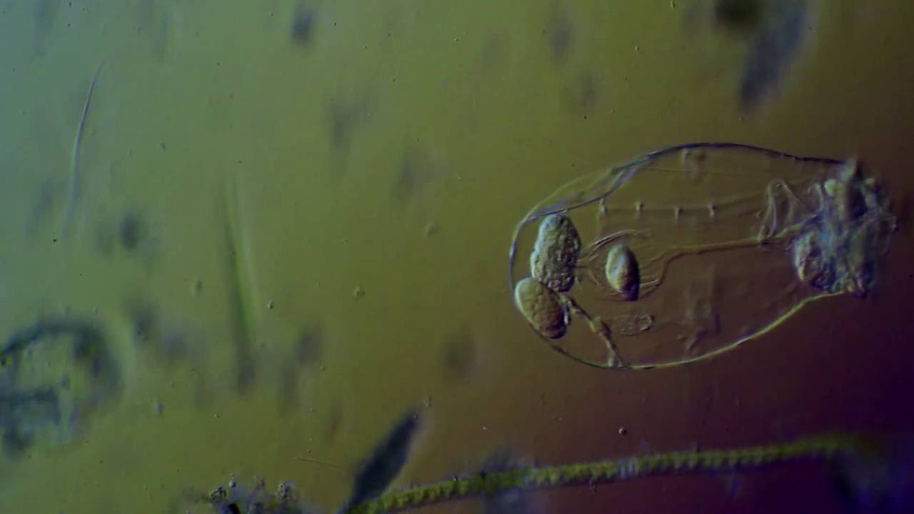 Asplanchna Rotifer - YouTube