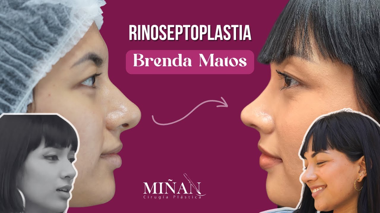 El nuevo perfil de Kimberly (Brenda Matos) de AFHS🤩 | Rino ultrasónica ...