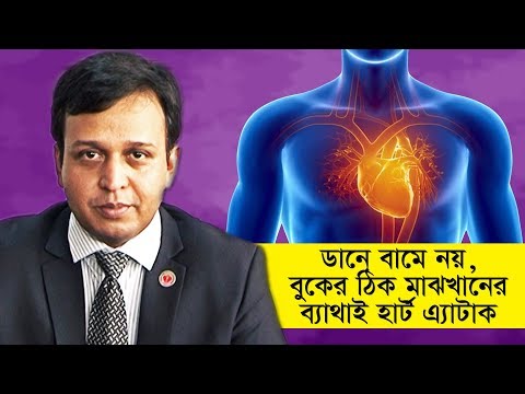 হার্ট এ্যাটাকের ব্যাথা কোথায় হয় | Heart Disease Syndrome | Goodie Life