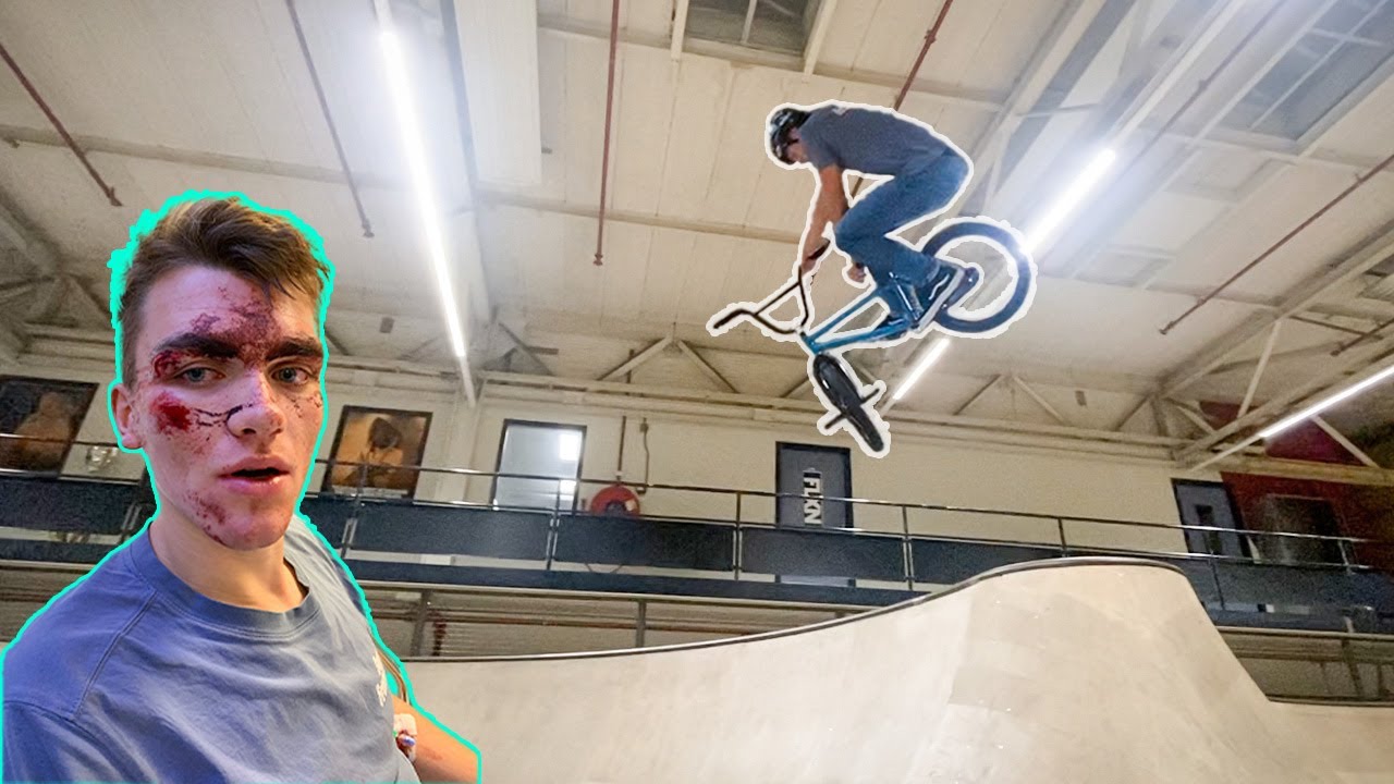 Making my Come back in Bmx after a massive INJURY! (Progression) - YouTube