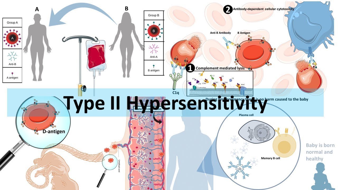 HYPERSENSITIVITY TYPE II, HAEMOLYTIC DISEASE OF THE NEWBORN, ERYTHROBLASTOSIS FETALIS - YouTube