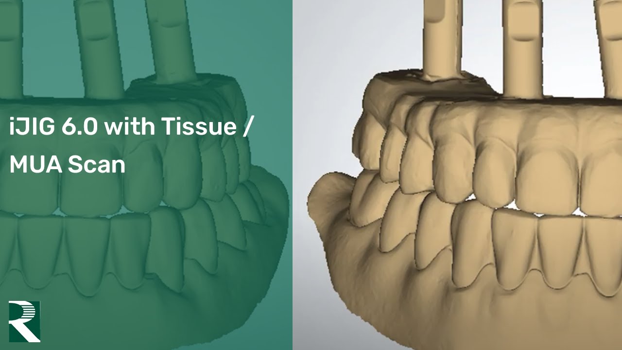 iJIG 6 0 with Tissue/MUA Scan - YouTube