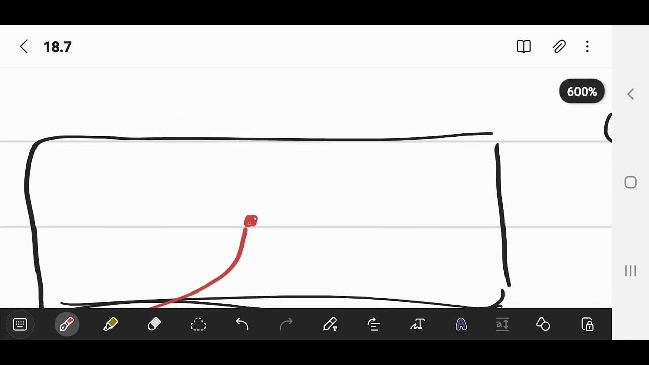 Angiodysplasia cause Lower GIT bleeding - YouTube