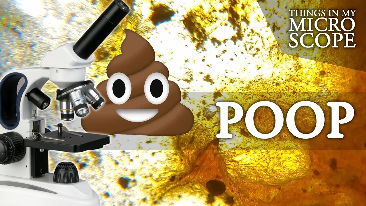 POOP UNDER MICROSCOPE - 100X 250X 1000X 4K - YouTube
