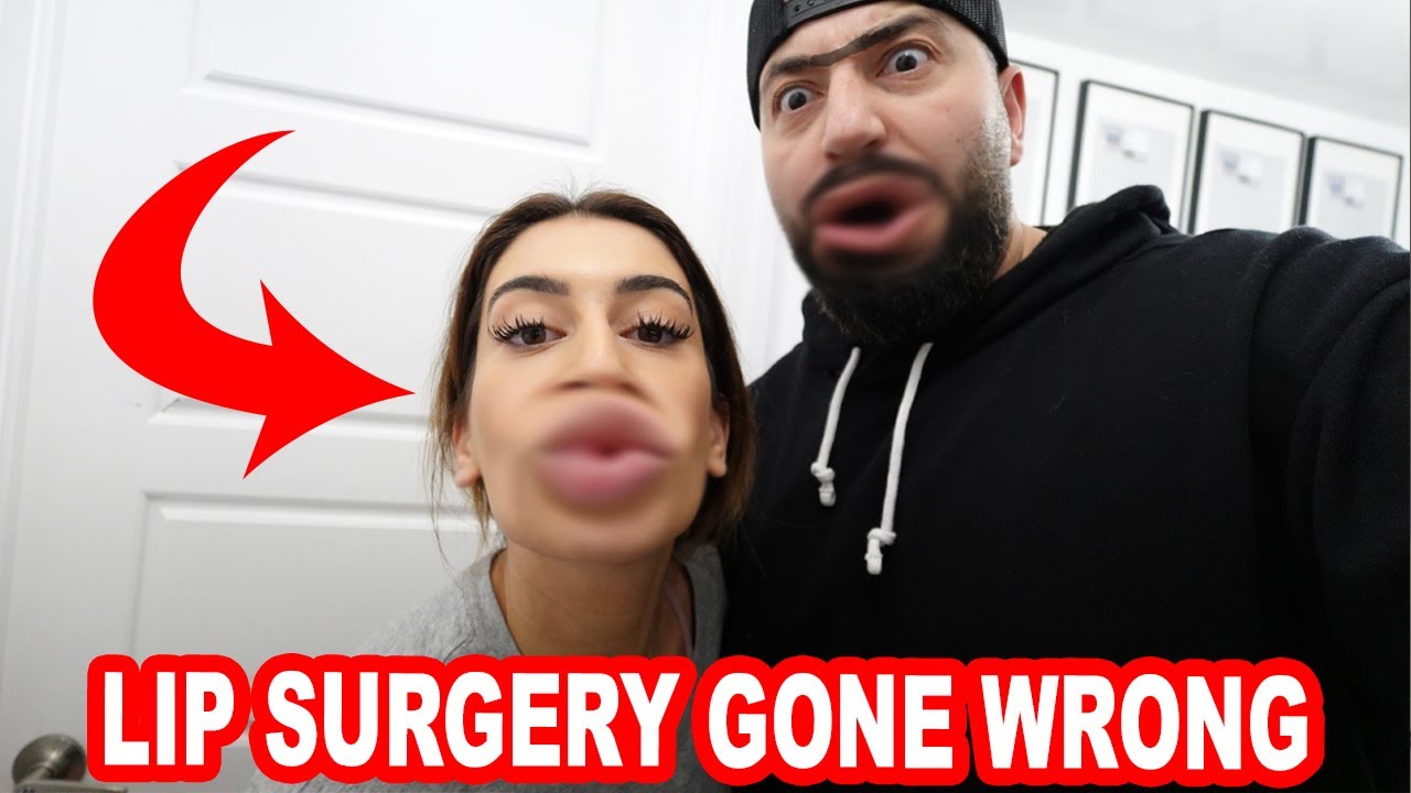 SHE GOT LIP SURGERY AND IT WENT WRONG! - YouTube