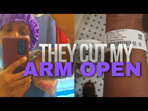 They Cut My Arm Open 💉| VLOG - YouTube