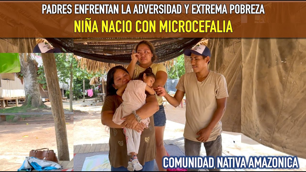 Niña con microcefalia, padres enfrentan la adversidad y extrema pobreza ...