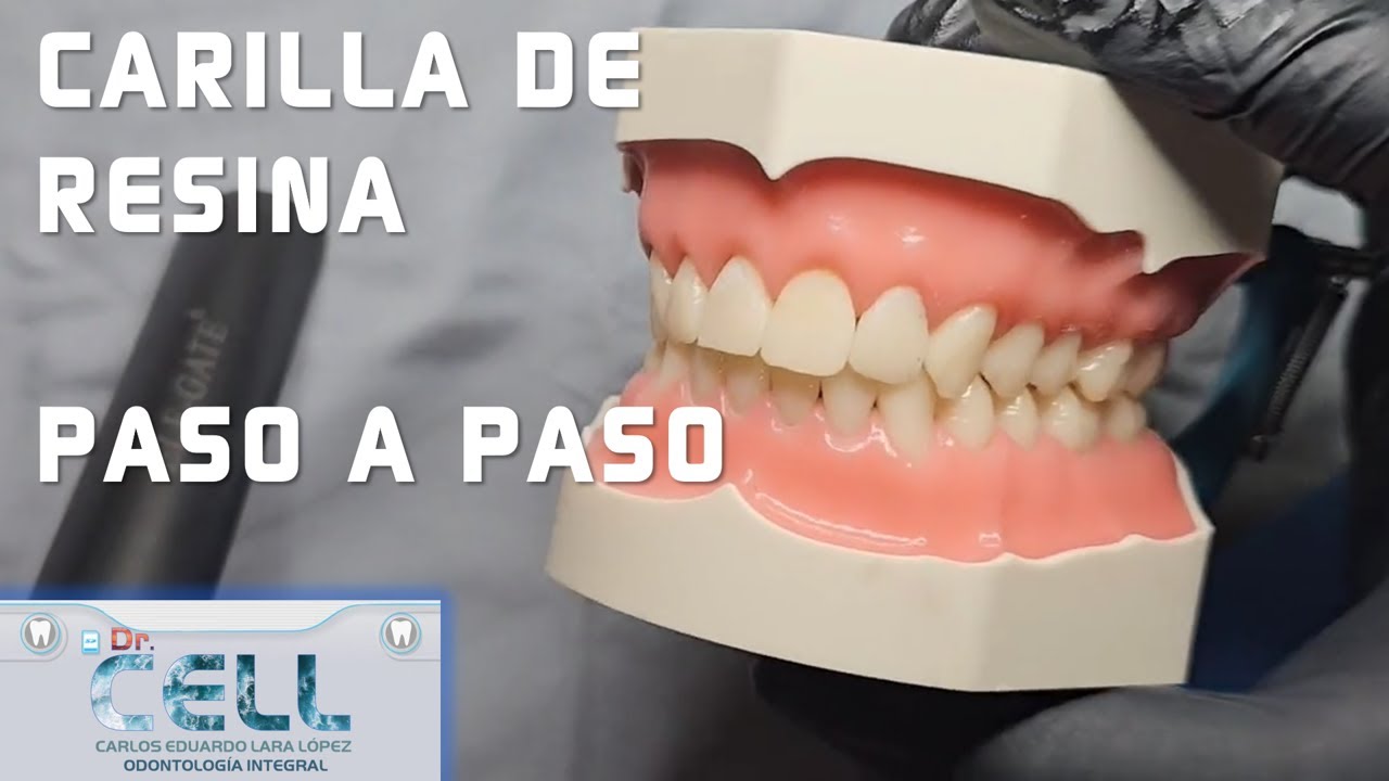 Carilla de Resina Paso a Paso - YouTube