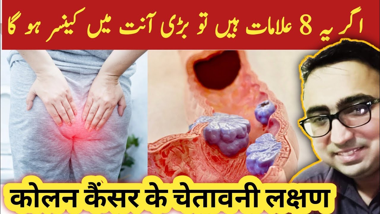 8 Early Warning Signs Of Colon Cancer You Should Not Ignore - YouTube