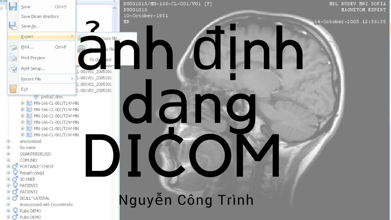 đọc file DICOM trên matlab-chuẩn dữ liệu về hình ảnh trong y tế-dicom ...
