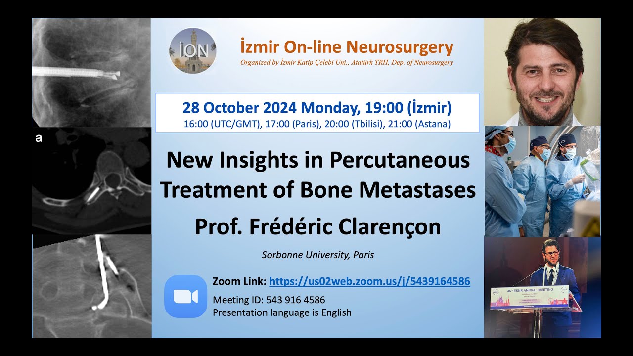 İON 477. Lecture, Clarençon: New Insights in Percutaneous Treatment of ...